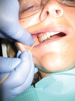 Anesthesia during perio: Maxillary injections useful for adult ...