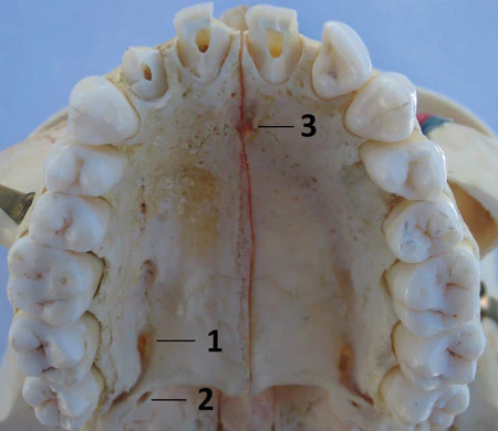 Incisive Foramen