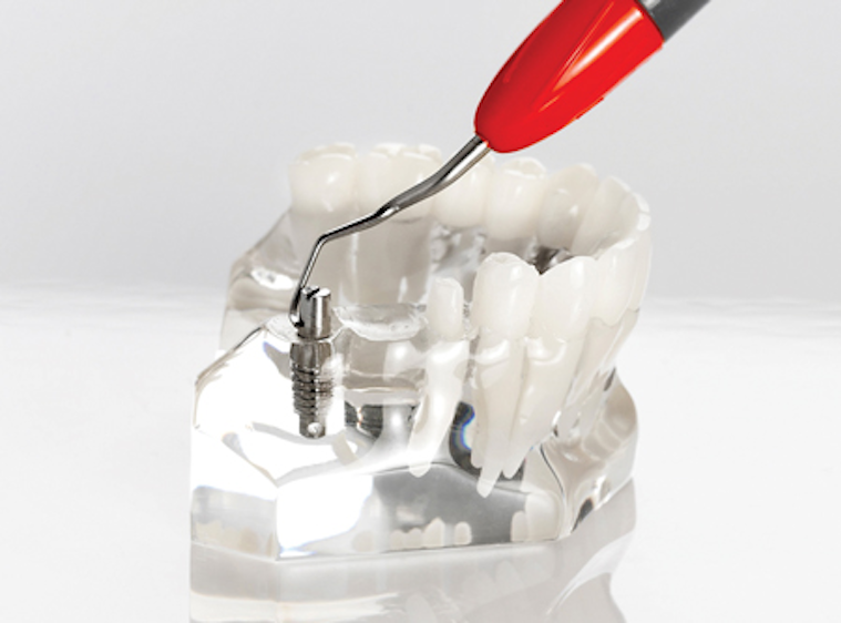 LM Dental's approach to implant care | Registered Dental Hygienists