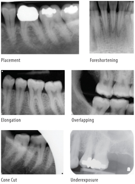 Best Practices and Patient Comfort with Digital Intraoral Radiography ...