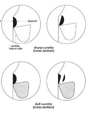 THE CUTTING EDGE | Registered Dental Hygienists
