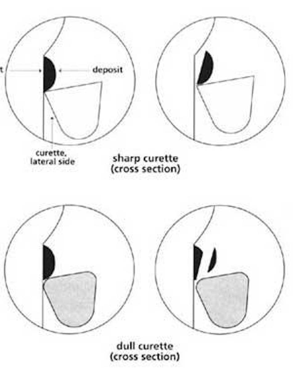 THE CUTTING EDGE | Registered Dental Hygienists