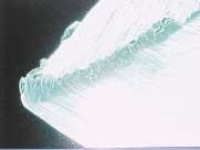 THE CUTTING EDGE | Registered Dental Hygienists