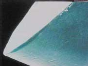 THE CUTTING EDGE | Registered Dental Hygienists