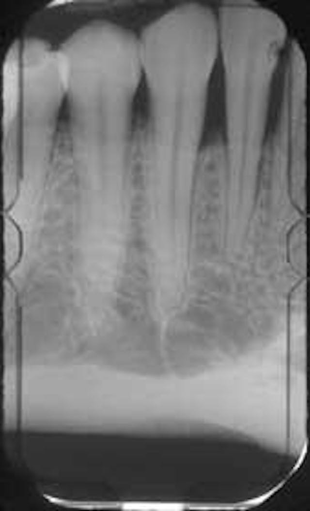Taking Diagnostic Quality X-Rays | Registered Dental Hygienists