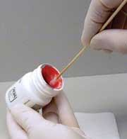 Pain control in dental hygiene | Registered Dental Hygienists