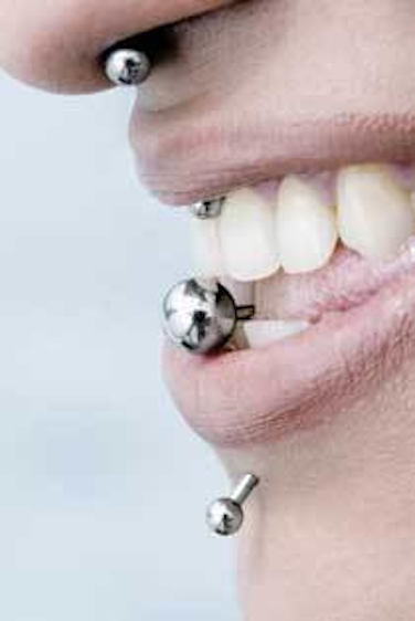 the perils of oral piercing | Registered Dental Hygienists