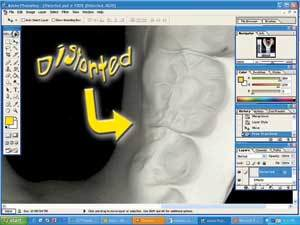 Imprints | Registered Dental Hygienists