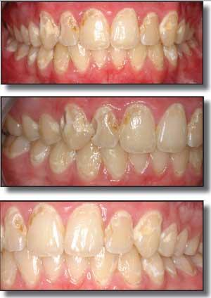 Arrested Development | Registered Dental Hygienists