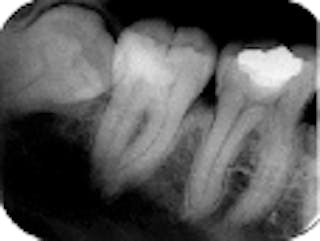 dental radiography errors