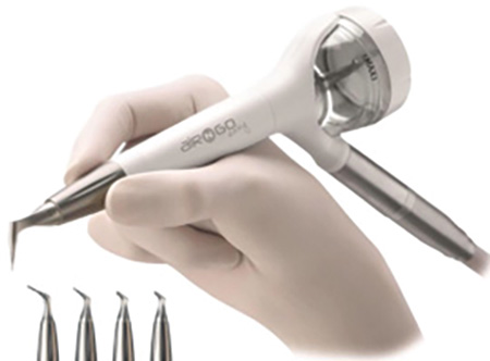 The surprising benefits of air: Low-abrasive powders for air polishers ...