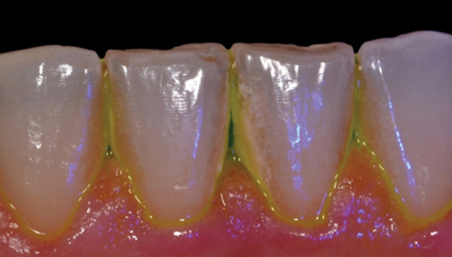 To disclose or not to disclose? Routine use of disclosing agents helps ...