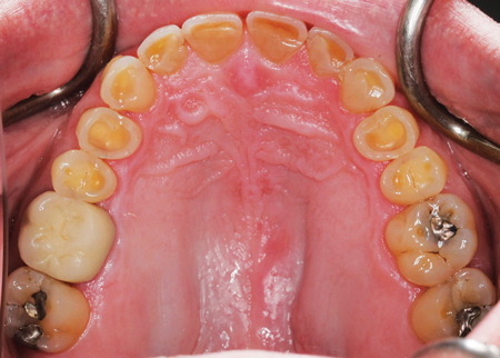 Protected by a safe RDA: Setting the record straight about toothpaste ...