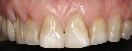 Protected by a safe RDA: Setting the record straight about toothpaste ...