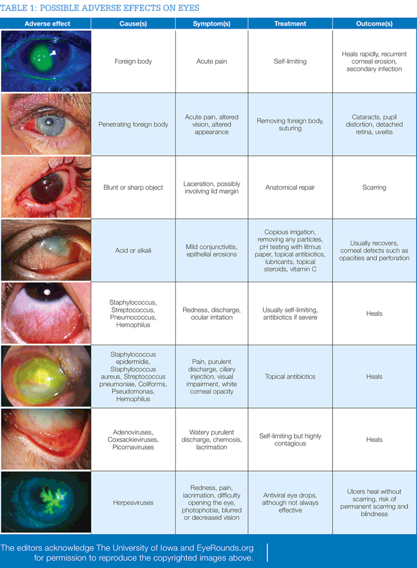 My eye's on you: Are dental professionals using safety glasses while ...