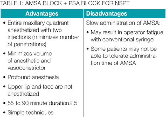 The AMSA nerve block: Pair with the PSA nerve block for hemimaxillary ...