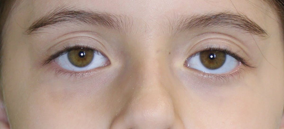 Eye spy: What the eyes can tell us about the mouth | Registered Dental ...