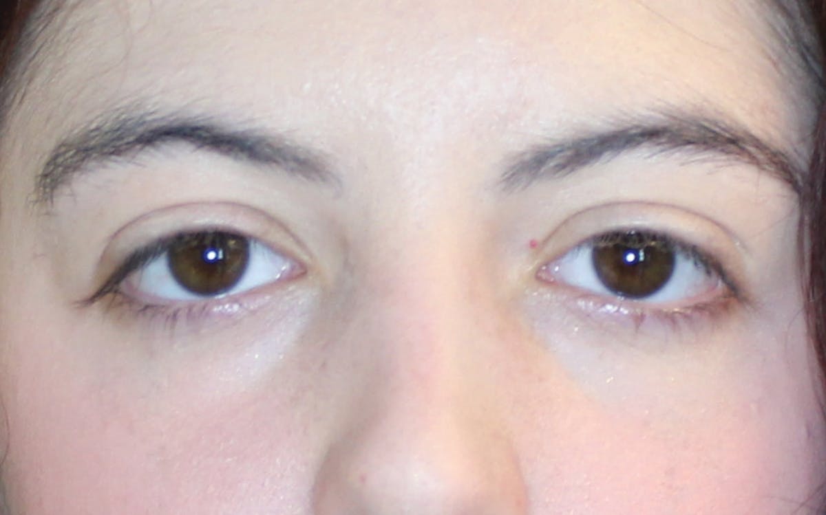 Eye spy: What the eyes can tell us about the mouth | Registered Dental ...