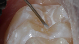 Home | Registered Dental Hygienist (RDH) Magazine