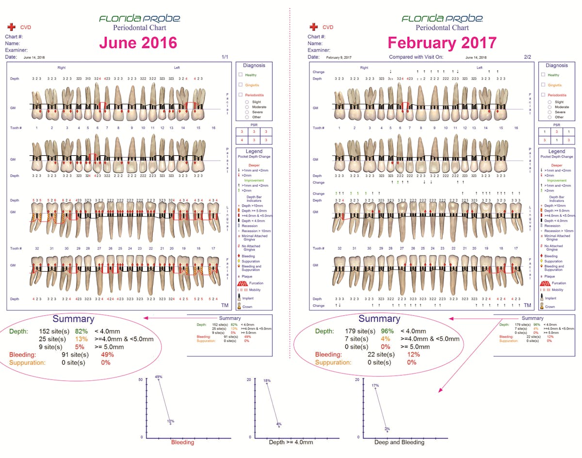 Untreated periodontitis and COVID-19? Let’s get progressive! Part 3 of ...