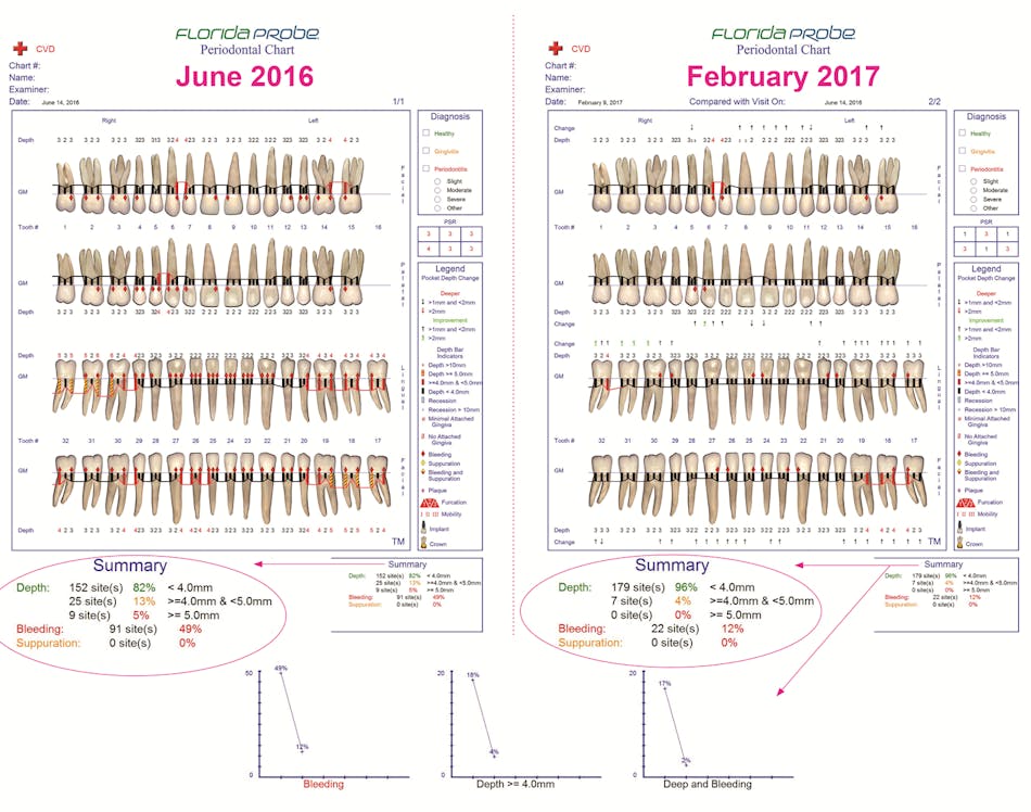 Untreated periodontitis and COVID-19? Let’s get progressive! Part 3 of ...