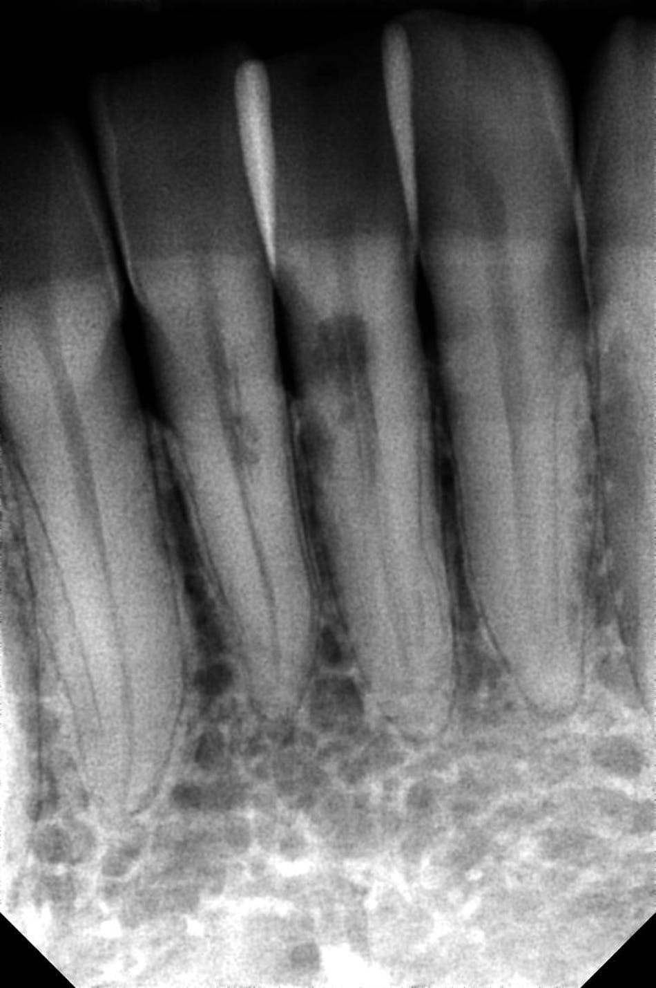 What’s that pink spot? Evaluating internal and external tooth ...