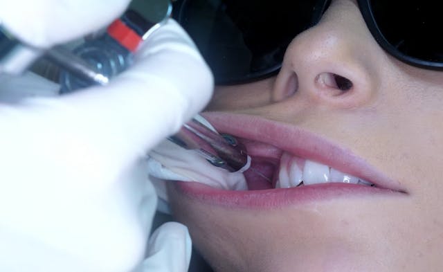 Stay SHARP with mandibular injection techniques | Registered Dental ...