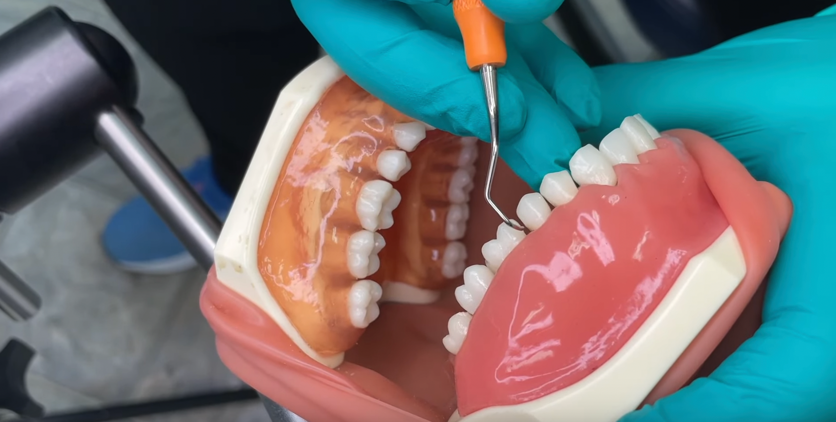 Differences between 11/12 and 15/16 Gracey Curettes | Registered Dental ...