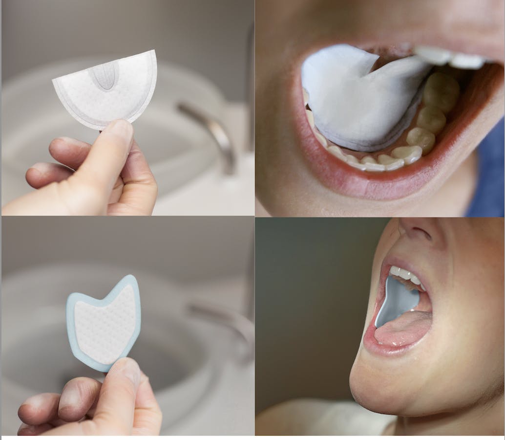 Perfectly placed, perfectly sealed: 10 best practices in dental sealant ...